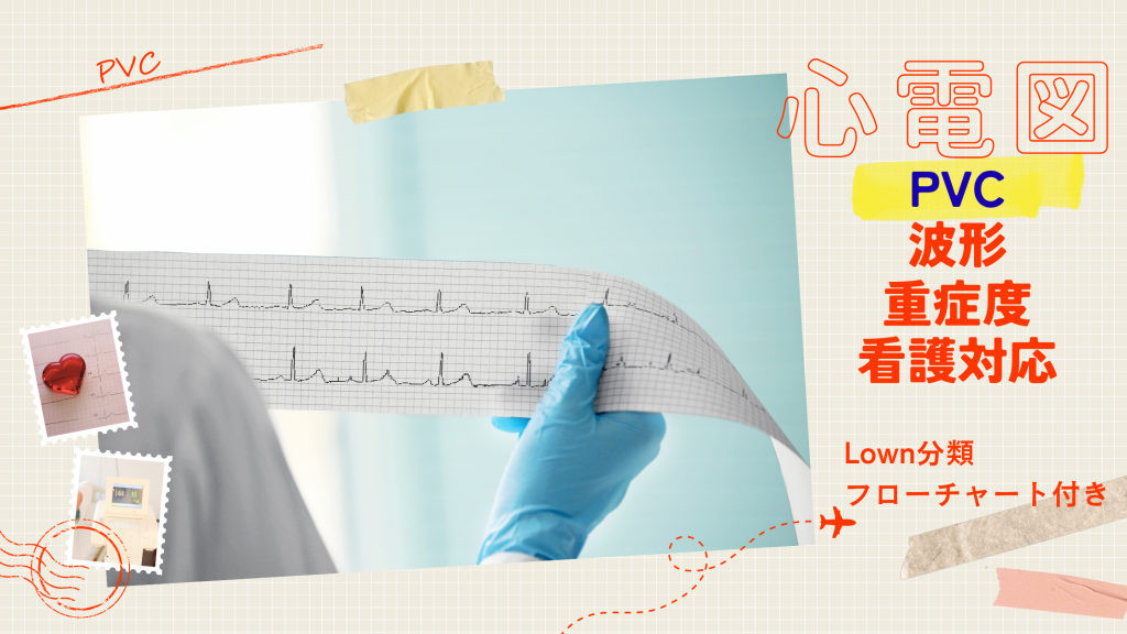 【保存版】PVC期外収縮の波形・重症度・看護対応がまるっとわかる！Lown分類＆フローチャート付き - しごとレトリバーガイド