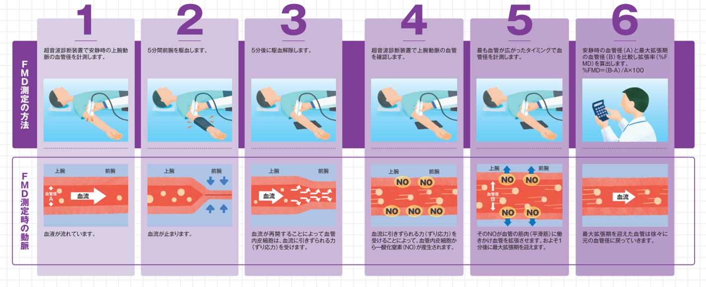 【看護師必見】内皮細胞の機能と障害｜動脈硬化・糖尿病との関係をやさしく学ぶ - しごとレトリバーガイド